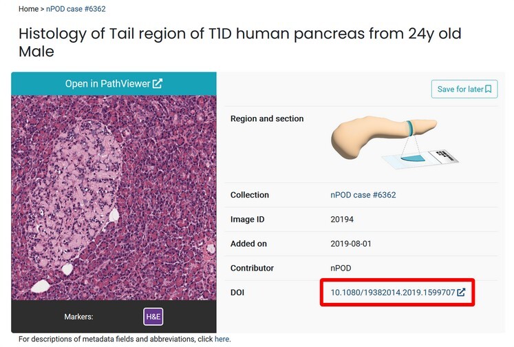Pancreatlas