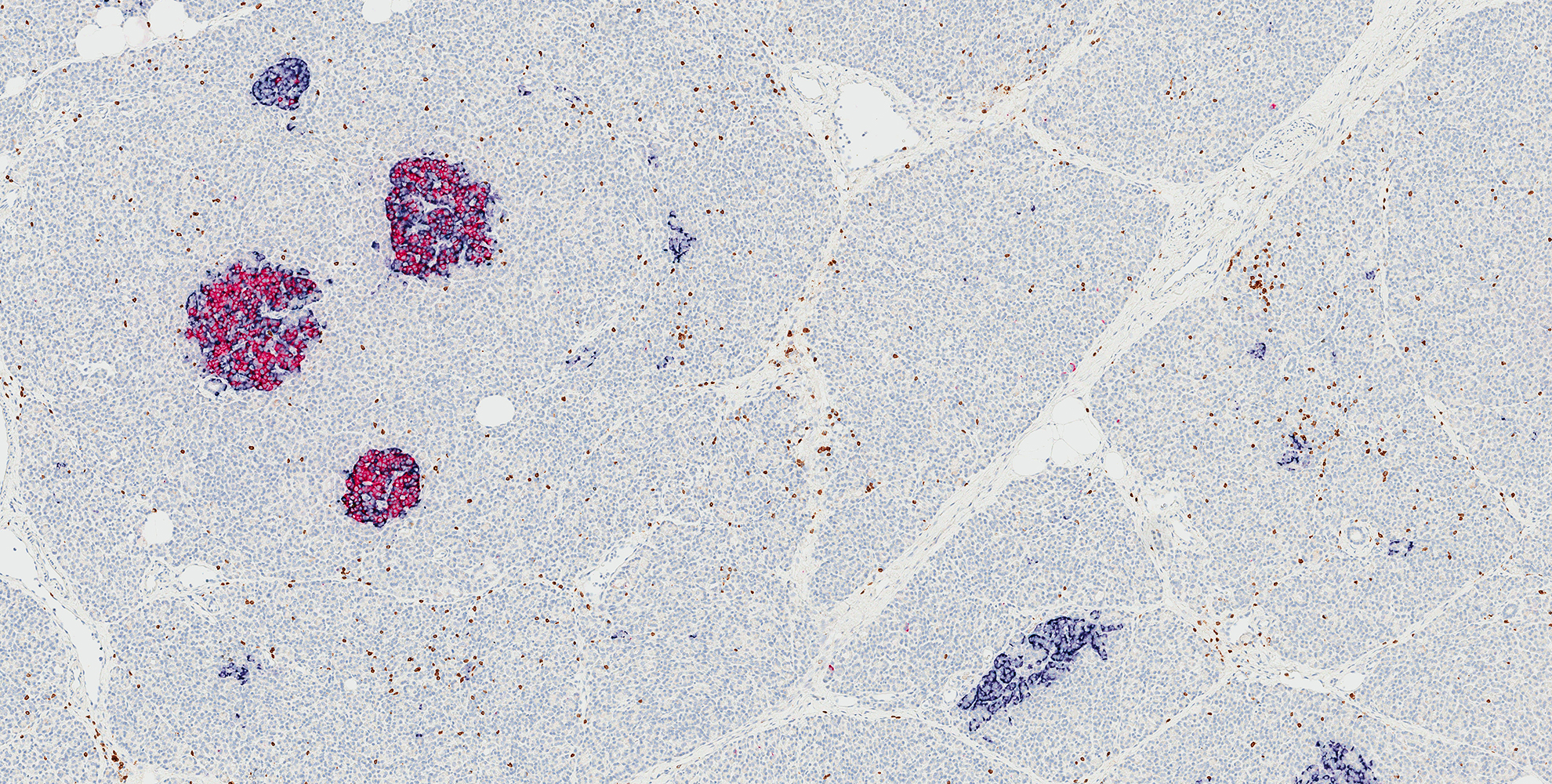 Pancreatlas